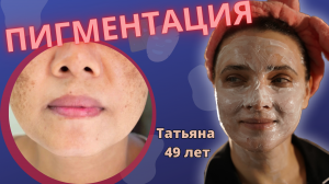 Пигментация