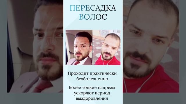??Пересадка волос??