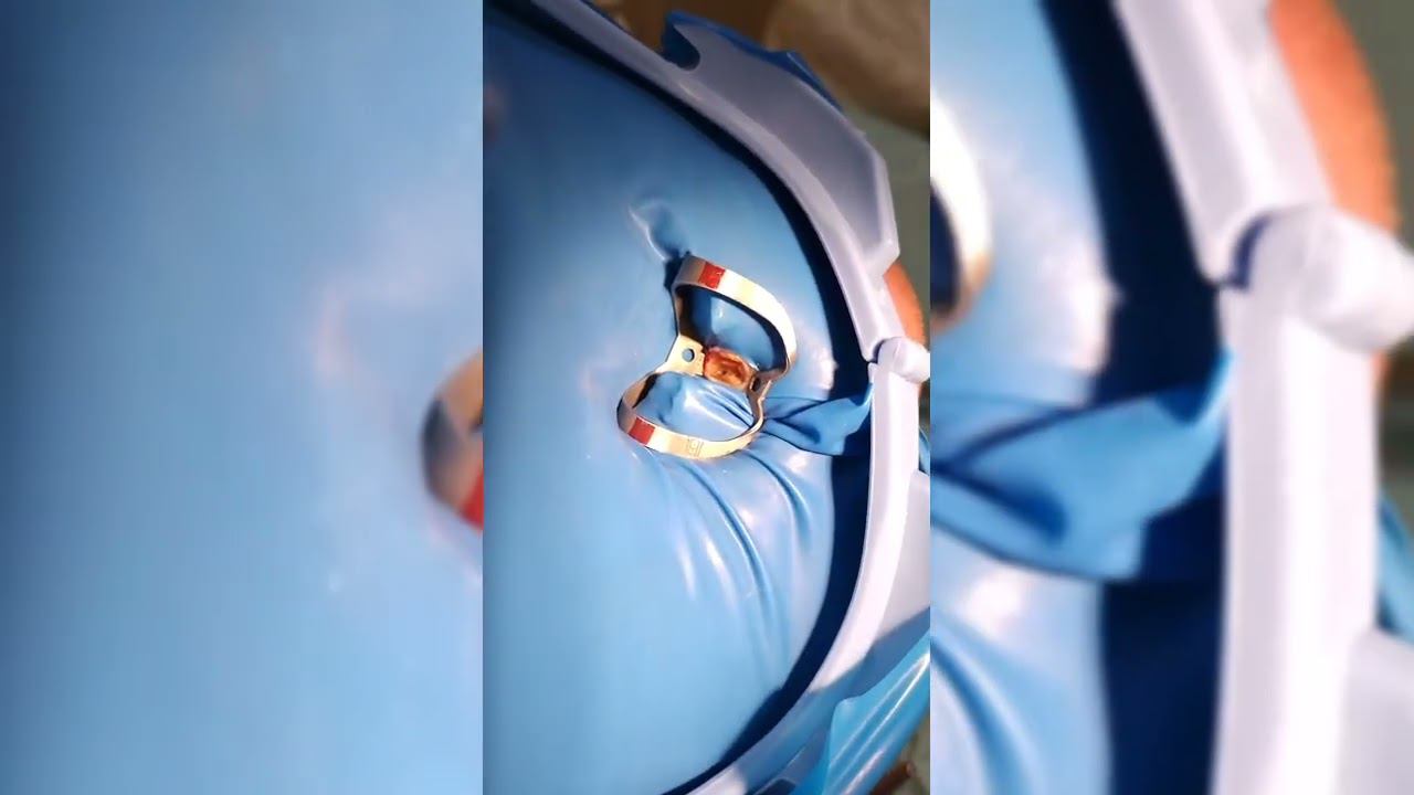Изоляция 44. Higenic W9. Rubber dam AO BO SI. blue.#4.Рамка Fit Frame.