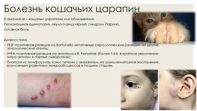 10. Инфекционная патология ч4.mp4
