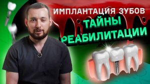 Секреты реабилитации после имплантации зубов. Хирург-имплантолог Салагаев Сослан.