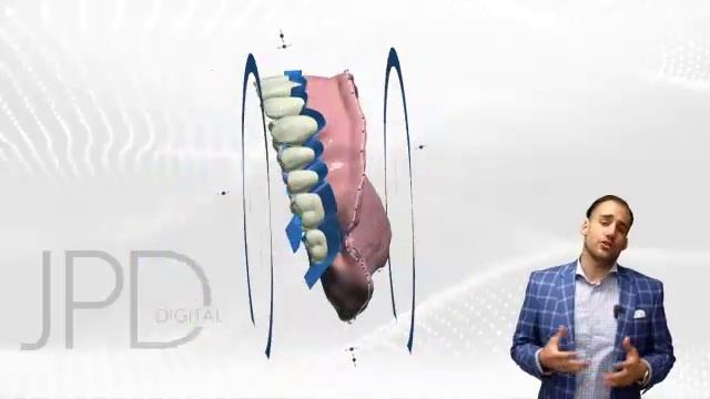 Технология изготовления полного съемного протеза методом фрезерования двухцветного монолитного диска