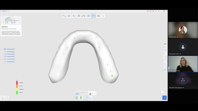 Вебинар: применение сканера Medit и 3D печать шины на принтере Ackuretta