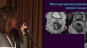 МРТ в персонализации лечения больных раком прямой кишки