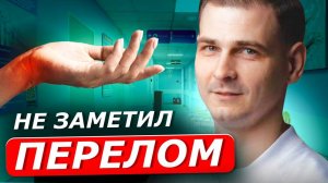 ПЕРЕЛОМЫ КОСТЕЙ | Как заметить незамеченный перелом?