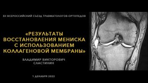 Результаты восстановления мениска с использованием коллагеновой мембраны