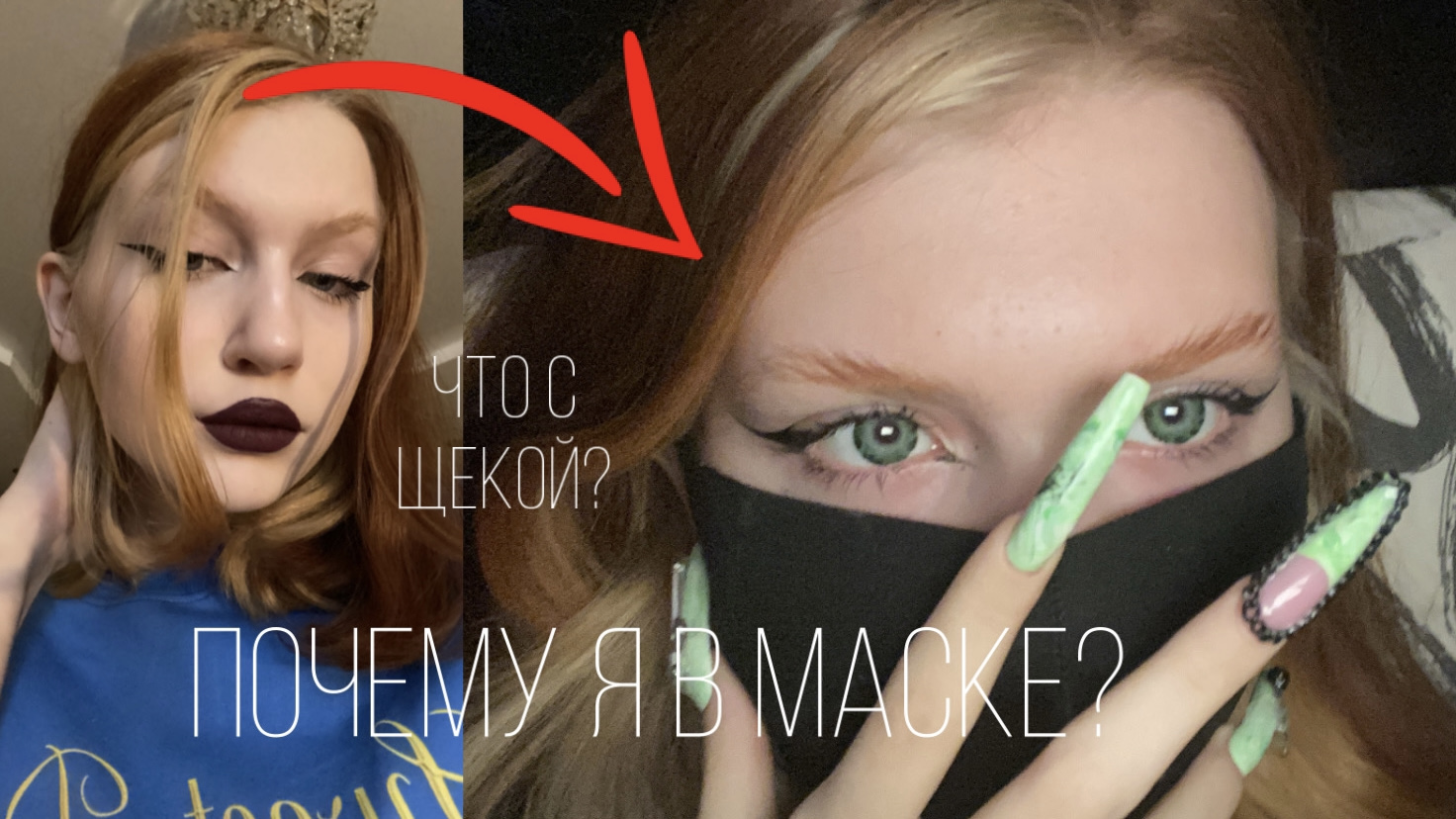 ИСТОРИЯ МОИХ ЗУБОВ🦋 / почему я была в маске?