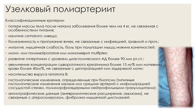13. Онкология и ревматические заболевания часть 2.mp4