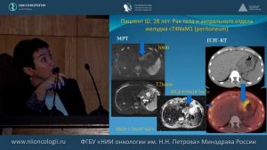 МРТ всего тела в онкологической практике