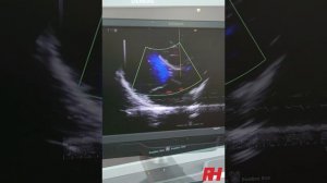 Siemens S1000 HELX Touch