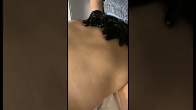 Стоун-терапия