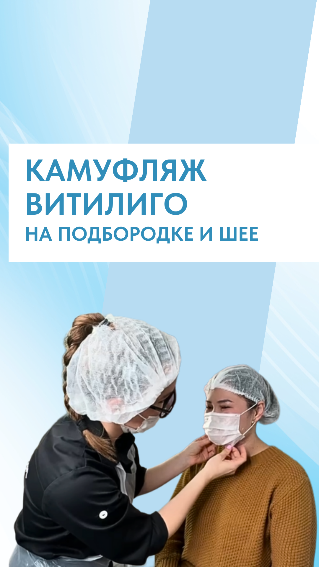 ЗАКАМУФЛИРОВАЛИ ВИТИЛИГО НА ПОДБОРОДКЕ И ШЕЕ