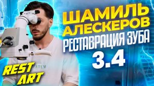 Реставрация зуба 3.4 - Шамиль Алескеров | RestART