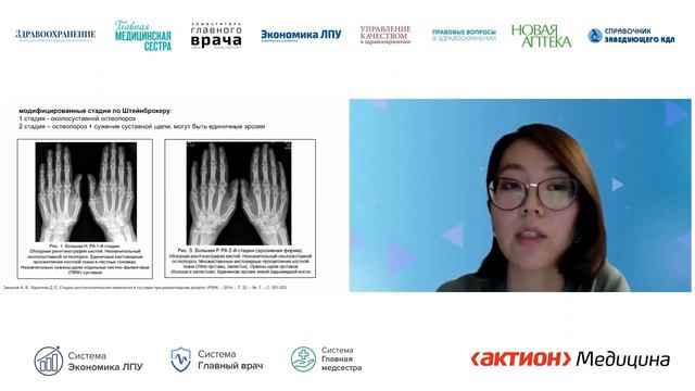 Инструментальная диагностика ревматоидного артрита