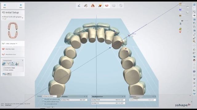 Цифровые полные съемные протезы: зубы Ruthinium + программа 3Shape