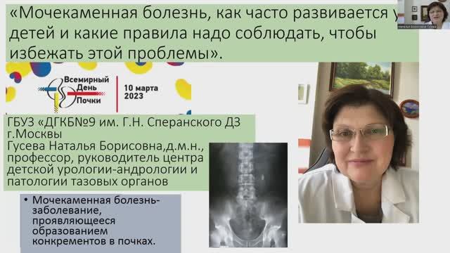 День почки. Мочекаменная болезнь у детей