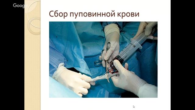 Урок 19. Пуповина и Плацента.mp4