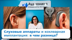 Слуховые аппараты и кохлеарная имплантация: в чем разница?