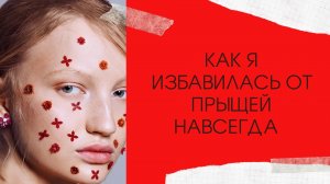 КАК Я ИЗБАВИЛАСЬ ОТ ПРЫЩЕЙ НАВСЕГДА