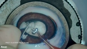 Prof. Vladimir Trubilin MD, Case 3