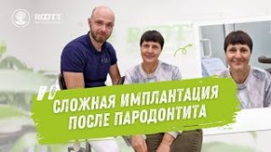 Отзыв —  сложная имплантация после пародонтита!