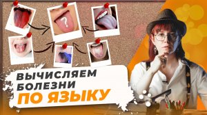Вычисляем заболевания по ЯЗЫКУ | Диагностика организма по языку