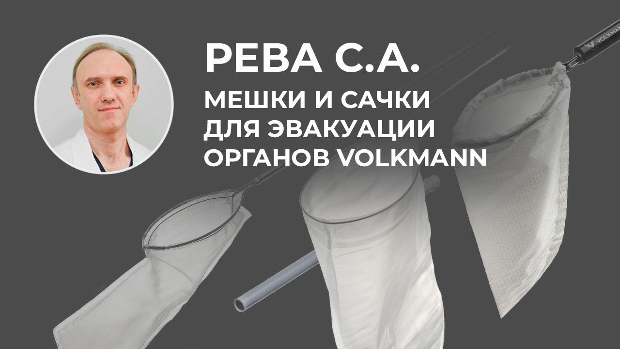 Отзыв на мешки для эвакуации органов Volkmann. Фрагмент операции простатэктомиии. Рева С.А