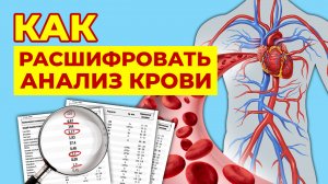 У ВАС ПЛОХИЕ АНАЛИЗЫ! ВЫ БОЛЬНЫ …? / Как расшифровать общий анализ крови?