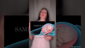 Естественные роды или кесарево. Что выбрать?