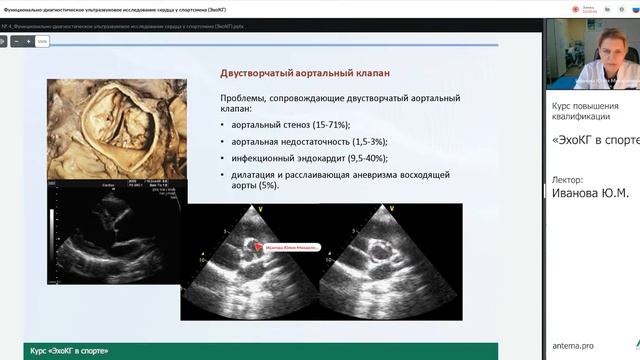 Функционально-диагностическое ультразвуковое исследование сердца у спортсмена (ЭхоКГ)