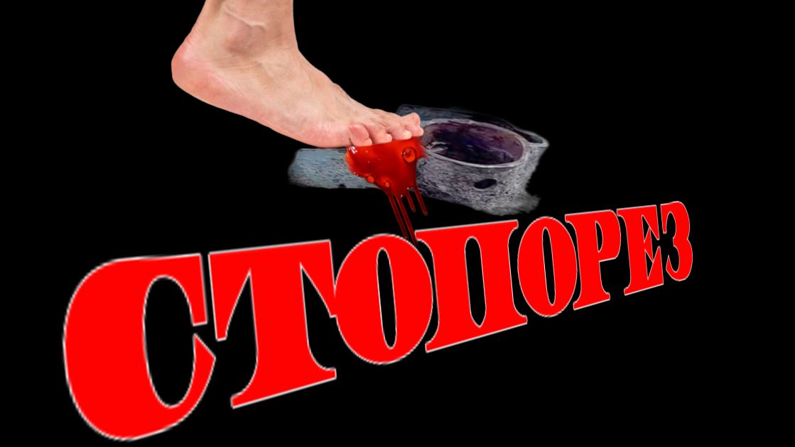 СТОПОРЕЗ