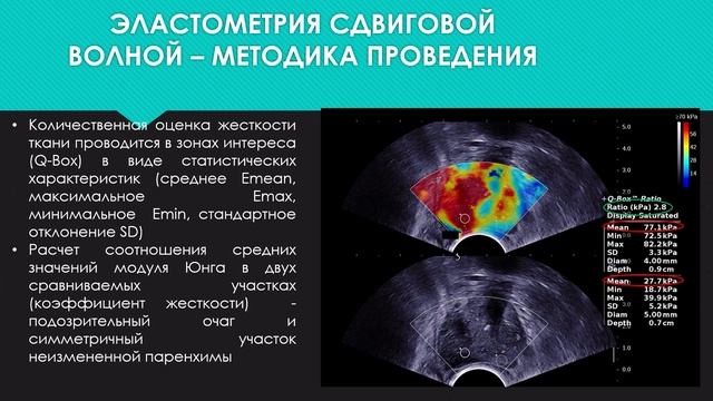 Ультразвуковое исследование предстательной железы - от ультразвуковой анатомии до современных техн.