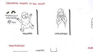 Community Acquired Pneumonia (DETAILED) Overview