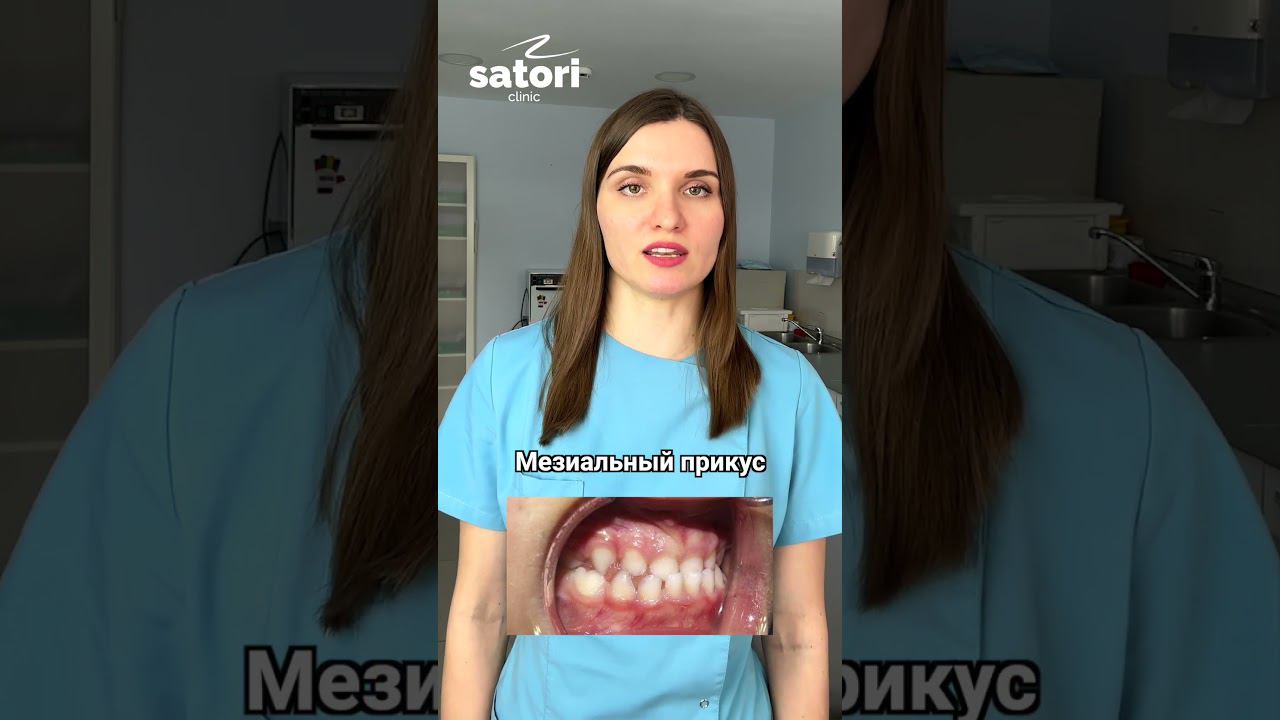 Показания к применению трейнера для исправления прикуса