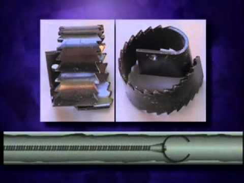 Электромеханический аппарат для прочистки канализации Крот-Метро.wmv