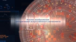 Диагностика гипертонической болезни по фотографиям сосудов глазного дна