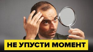 Когда уже поздно пересаживать волосы? |  Долгов Александр Николаевич