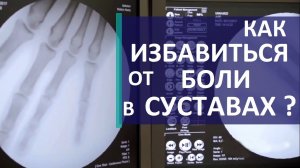 Боли в суставах причины. ? Диагностика причин боли в суставах. Скандинавский центр здоровья.