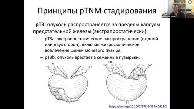 7 из 8 Вырезка и стадирование_1080p