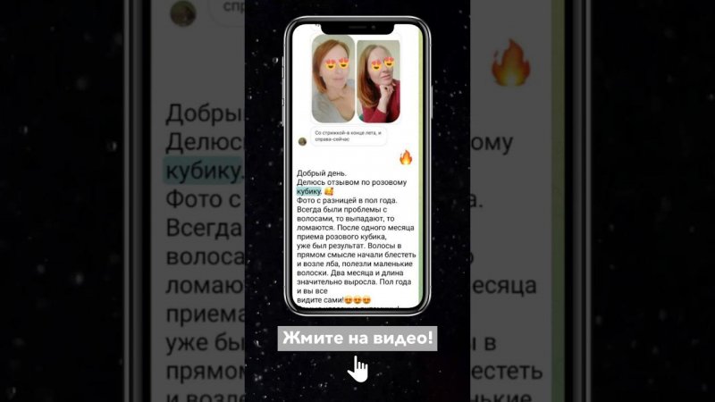 ВНИМАНИЕ! Обязательно смотреть, если выпадают волосы|как остановить волосопад?