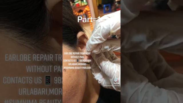 Earlobe reparing treatment without pain available #earlob #sumnimabeautypalour #conctactus982436898
