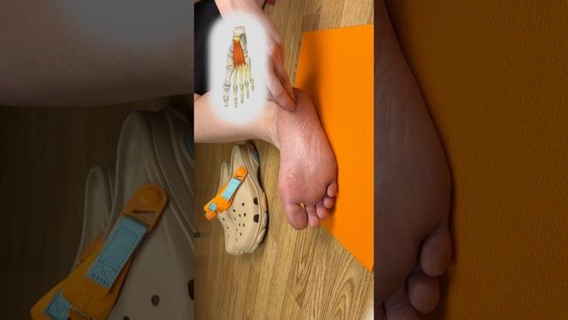 Боль в стопе по головкам 2-5 плюсневых костей / Короткий сгибатель пальцев / Саморастяжка