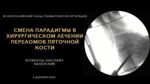 Смена парадигмы в хирургическом лечении переломов пяточной кости