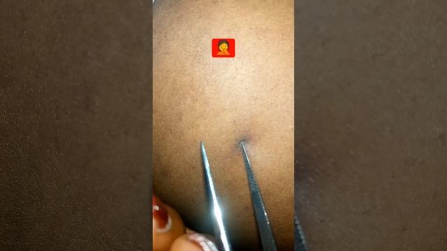 ? The pain
