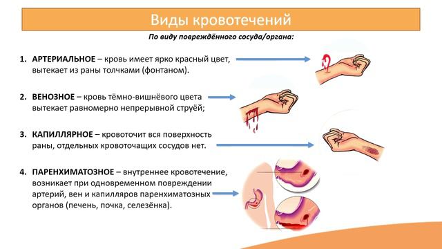 9.1. Кровотечения. Острое малокровие