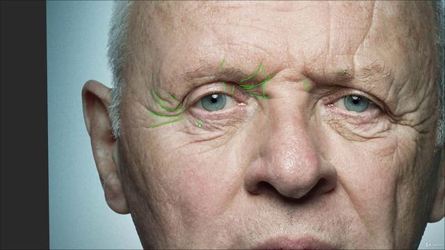 22. Anatomical Structures around the Eyes