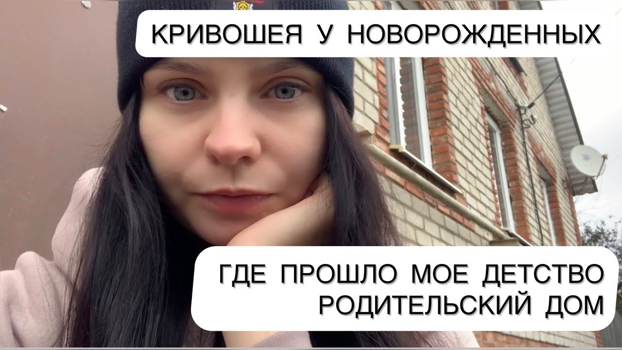 КРИВОШЕЯ новорожденных Где я жила раньше • назначили массаж малышу • приём НЕВРОЛОГА