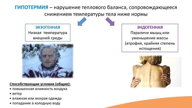 13.4. Гипотермия