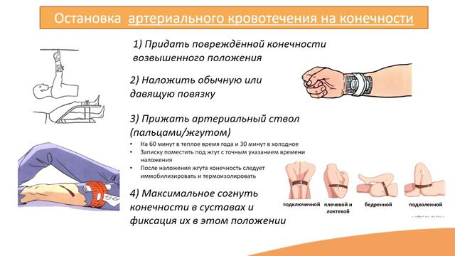 9.2. Методы остановки кровотечений