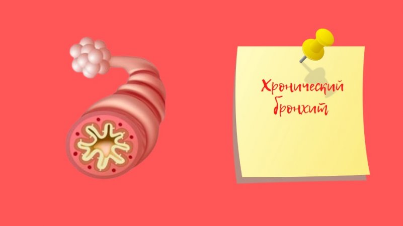 Хронический бронхит | Как лечить
